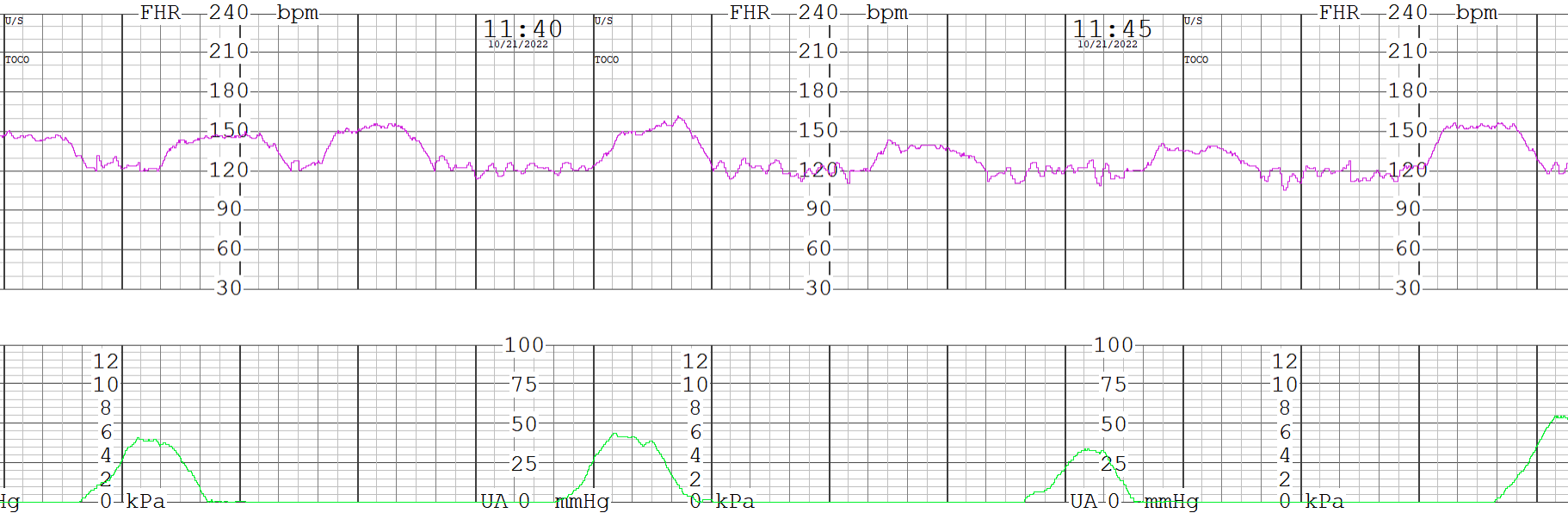 Home | OBIX P.O.E.T.